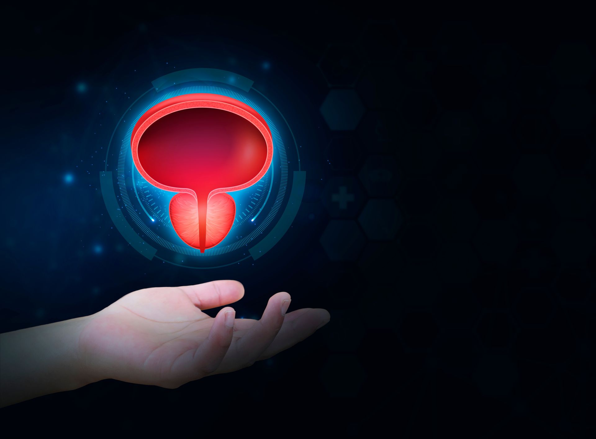 La Hiperplasia Benigna de Próstata: todo lo que debes conocer sobre el ...